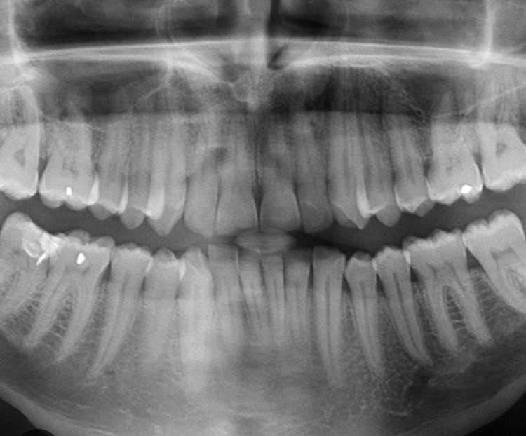 Digital Radiographs (X-Rays) | Emergency Services Milton MA